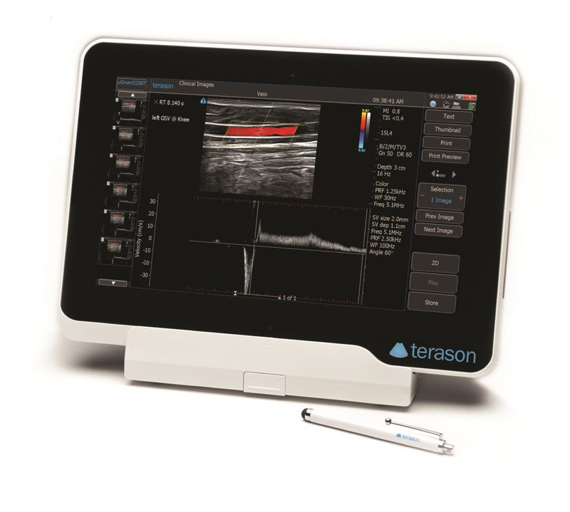 Terason uSmart 3200T Ultrasound